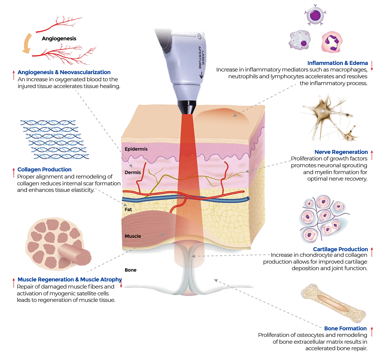 Mobile Laser Therapy